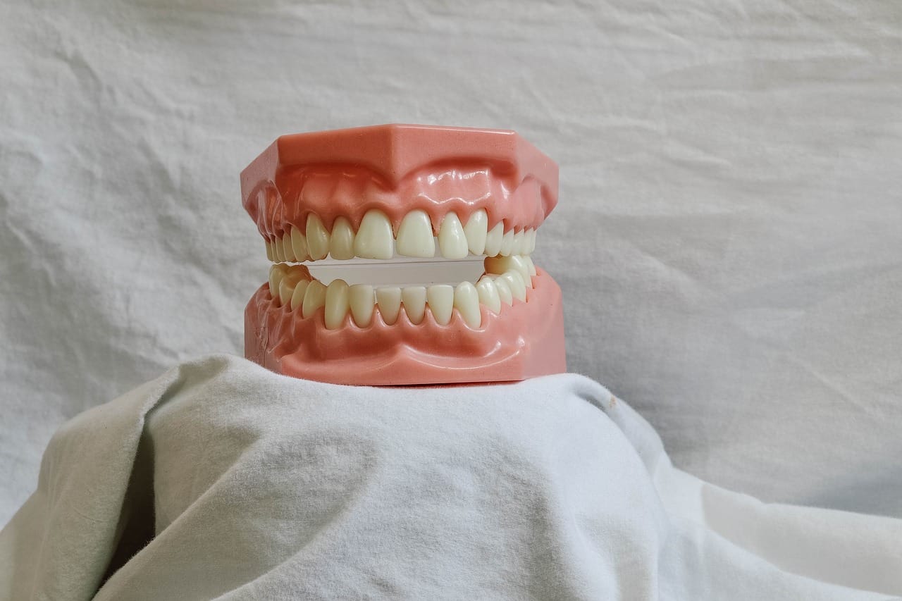 The Process of Bone Grafting for Dental Implants - Diamond Dental Care